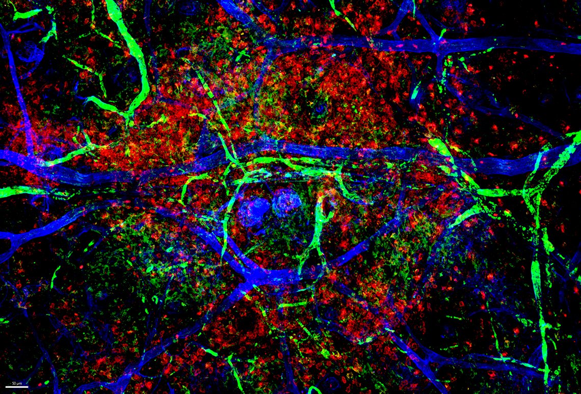 NIAID Fellow Uncovers the Skin’s Natural Immunity | NIH Record